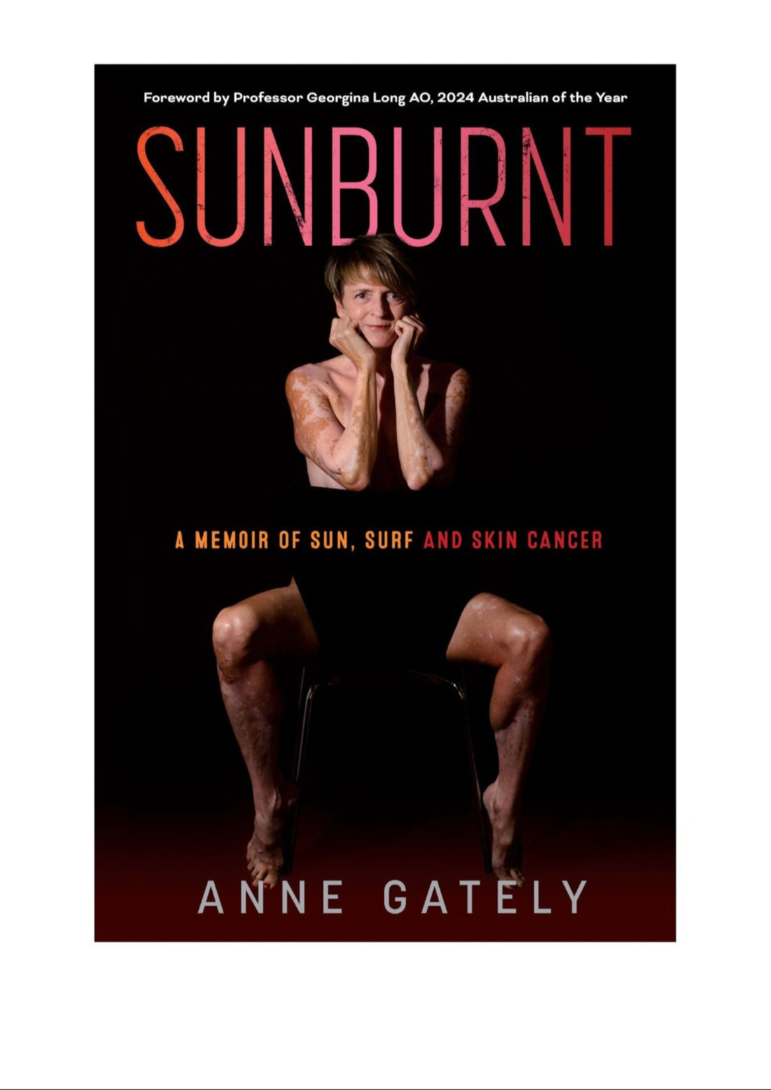 Sunburnt. PAPERBACK – Anne Gately